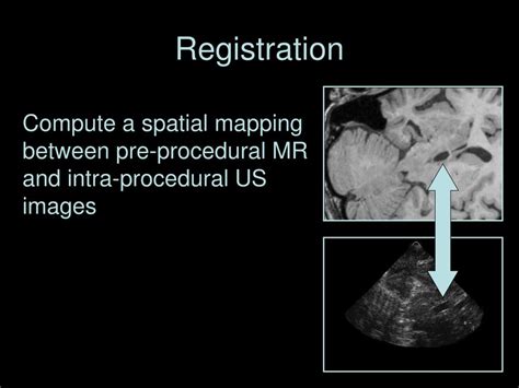 Ppt Non Rigid Mr Ultrasound Registration For Neurosurgery Prostate