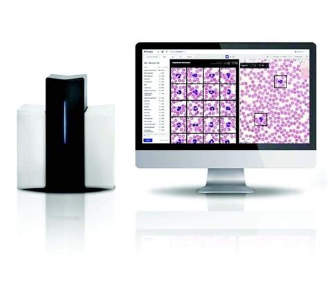 Siemens Healthineers Scopio X100 Digital Cell Morphology Scopio X100