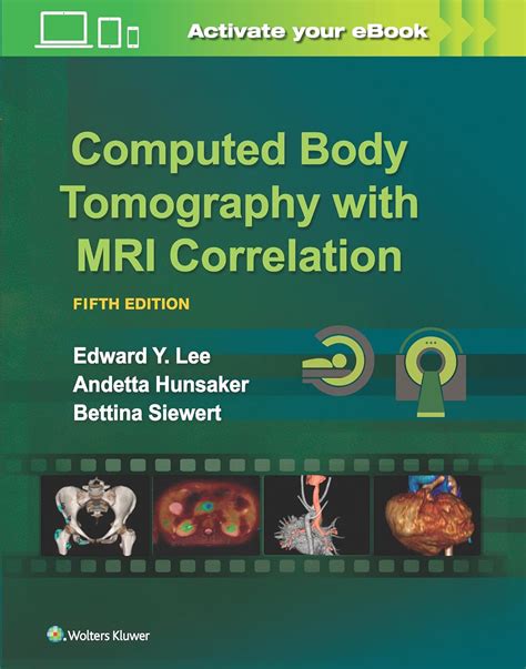 Computed Body Tomography With Mri Correlation 9789389702330 Books