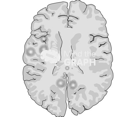 Free Brain Activation After Training Orbitofrontal Cortex Icons