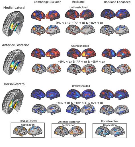 Results Of First Analysis On Caudate Functional Connectivity Across 3 Download Scientific