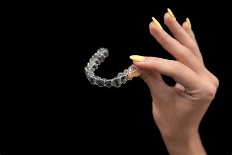 Выпрямление зубов элайнерами: особенности и преимущества выпрямления ...