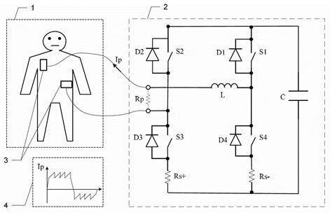 Defibrillator Discharge Circuit At Deanna Sellers Blog