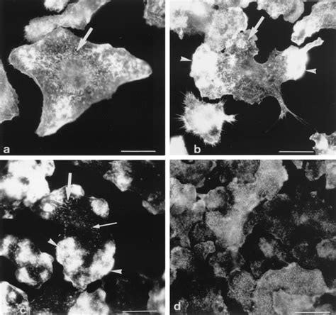 Pathogenic Mycobacteria Disrupt The Macrophage Actin Filament Network Abstract Europe Pmc