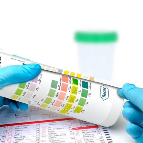 Combur 6 Test 50 Pcs Buy Online Blue Care