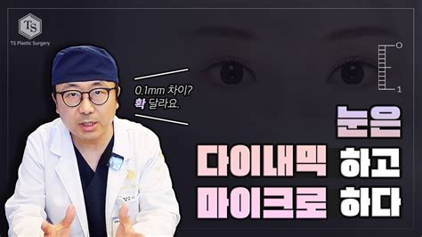 눈 수술이 어려운 이유 L 티에스성형외과 Youtube