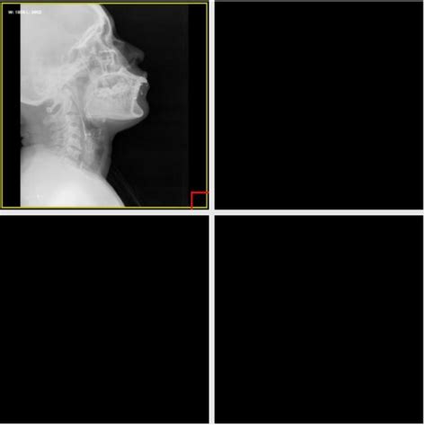 Product Review Cross Platform Html5 Compliant Medical Imaging With