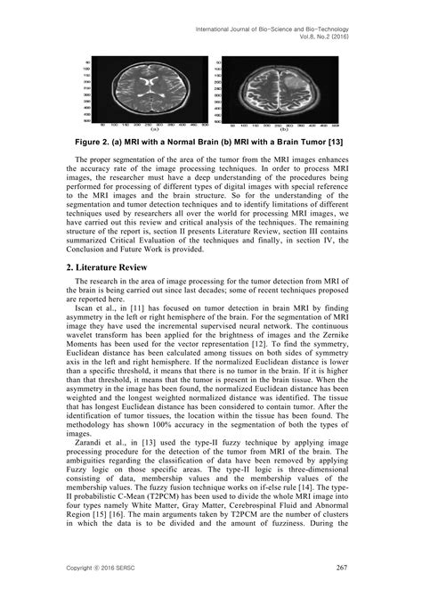 An Evaluation Of Automated Tumor Detection Techniques Of Brain Magnetic Resonance Imaging Mri Pdf