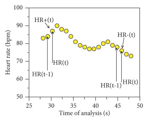 Heart Rate Analysis Over The Time Of VR Experiment A Procedure Download Scientific Diagram