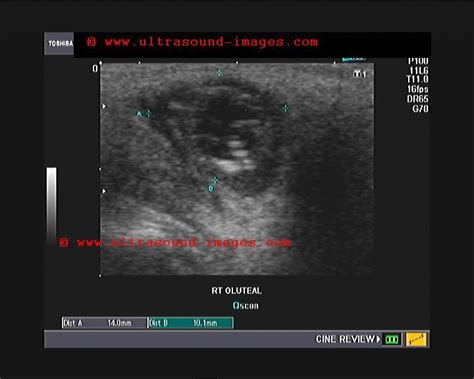 A Gallery Of High Resolution Ultrasound Color Doppler And 3d Images