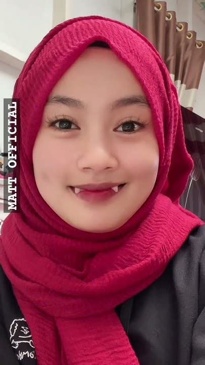 Windia Axsel Gingsul Cantik😍😍 Mattalpa Stor Shorts Youtube Shorts