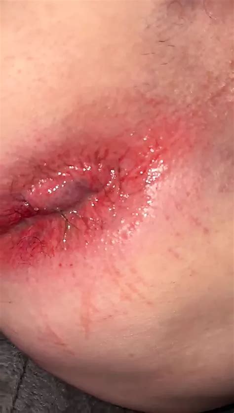 My Cum Filled Ass XHamster