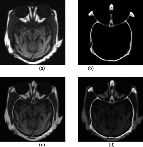 figure 1 from a pixel level image fusion framework based on structural