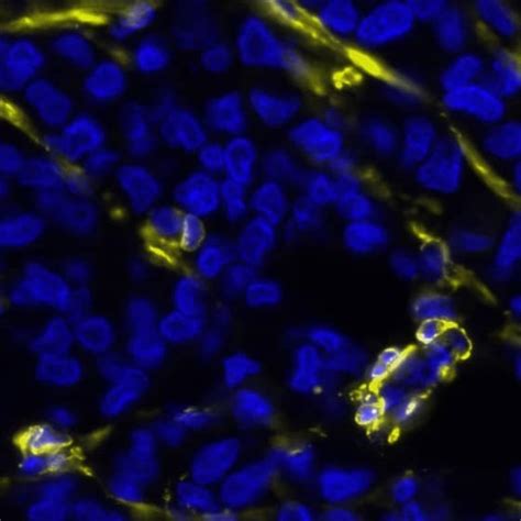 Detection Of Alpha Smooth Muscle Actin In Human Breast Tumor Via Seqif™ Staining On Comet™