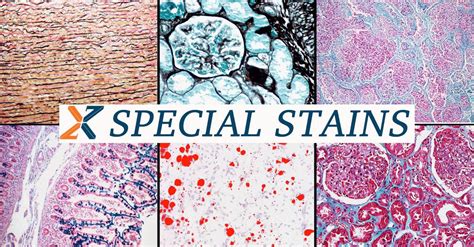 Biogenex On Linkedin 30 Pathology Special Stains For Diagnosis Are