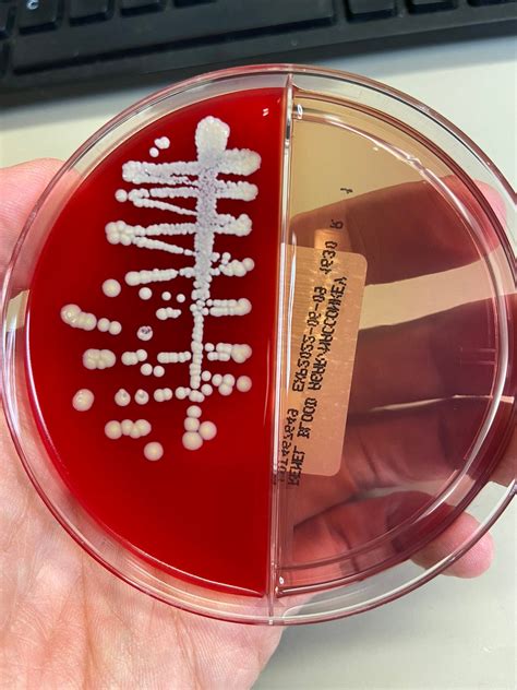 Microbenotes Staph Saprophyticus From A Urine Culture