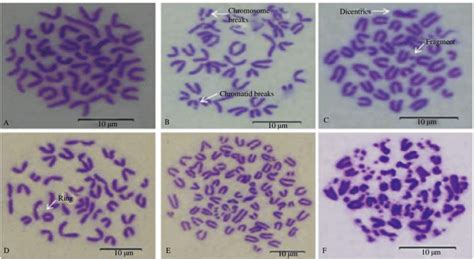 Figue 4 Radiation Induced Chromosomal Aberrations In Mouse Bone