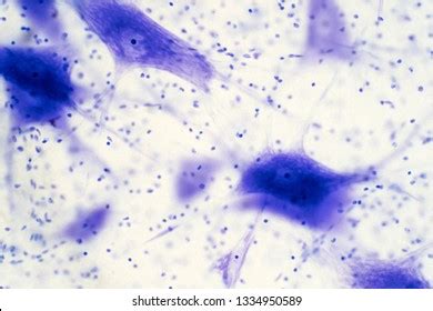 Neurons Cells Brain Under Microscope View Stock Photo Edit Now