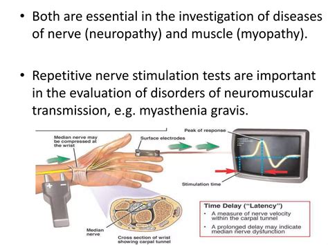 Eeg Interpretation Pptx