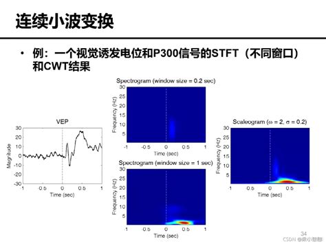 脑电时频图python 脑电图频谱分析 Mob64ca14173efa的技术博客 51cto博客