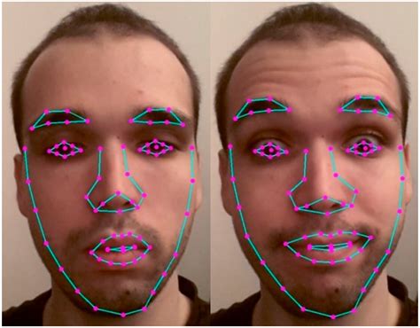 Predicting Depression Anxiety And Stress Levels From Videos Using The Facial Action Coding System