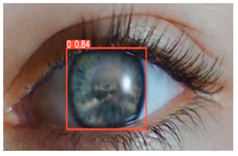 research on pupil center localization detection algorithm with improved