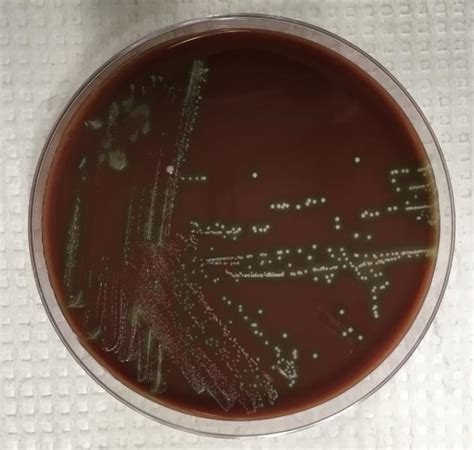 Streptococcus Pyogenes En Agar Chocolate Un Análisis Detallado Adn