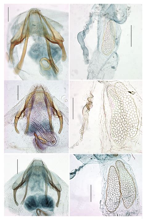 Ectoedemia Ectoedemia Populella Group Female Genitalia Dorsal Download Scientific Diagram