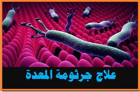 علاج جرثومة المعدة