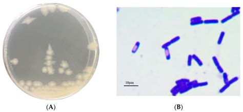 Bacillus Cereus Acid Fast Stain