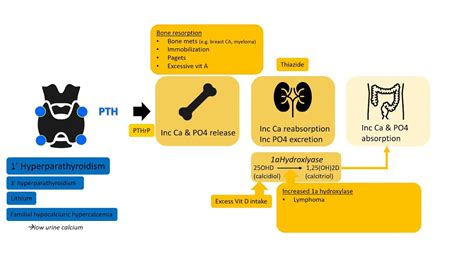 Hypercalcemia Diagnosis And Management Youtube
