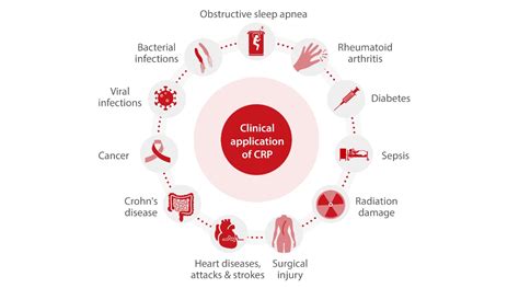 Exploring The Medical Applications Of C Reactive Protein Mindray