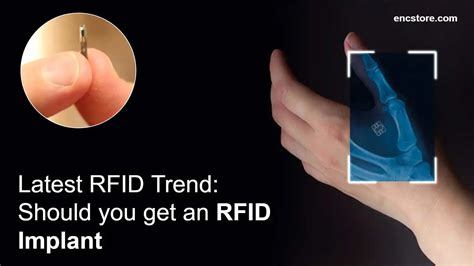Latest Rfid Trend Should You Get An Rfid Implant