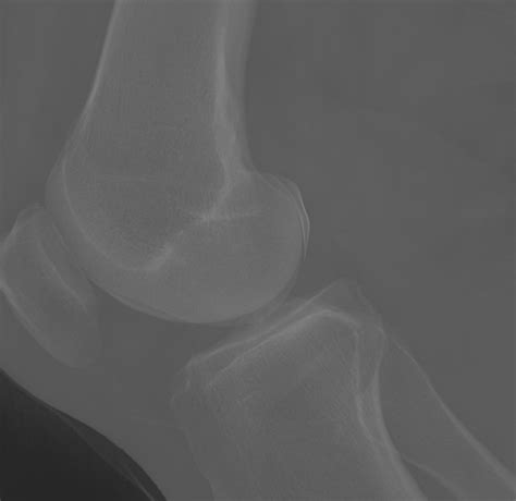X Ray Knee Pose Detection Keypoint Detection Dataset By Oilclass