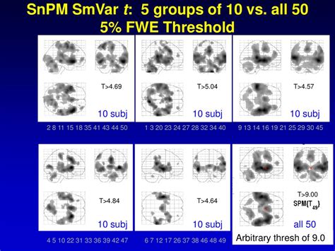 Inference On Spms Random Field Theory And Alternatives Ppt Download