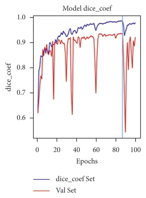 Validation Set Trends Of Loss And Dice Coefficients For Each Method In Download Scientific