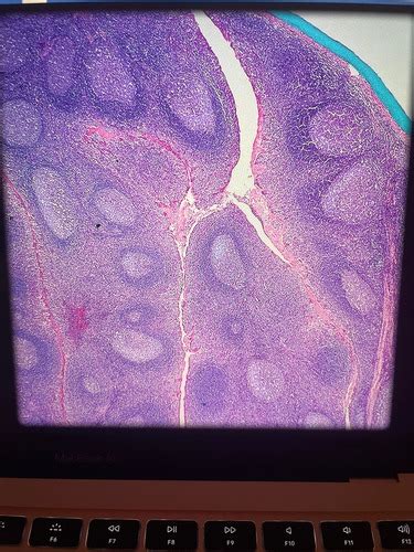 Palatine Tonsilandpeyers Patch Flashcards Quizlet