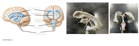 Biol243l Ventricles Diagram Quizlet
