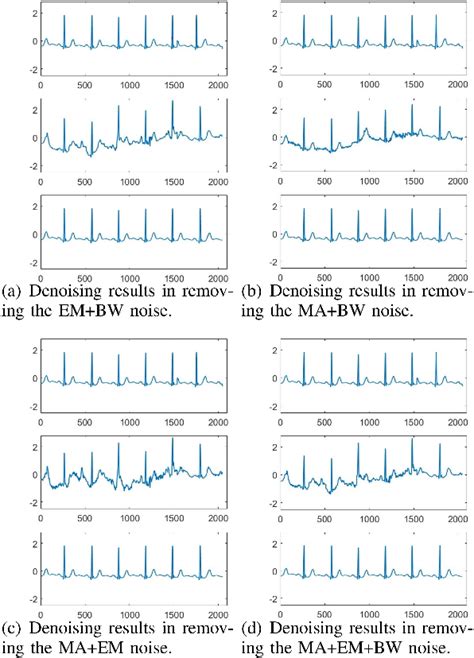 figure 1 from an ecg signal denoising method using conditional