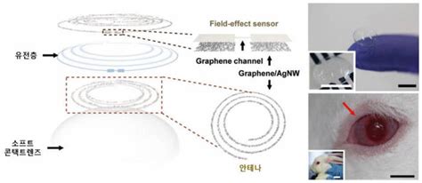 박장웅 Unist 교수팀 혈당과 안압 체크하는 스마트 콘택트렌즈 개발 전자신문