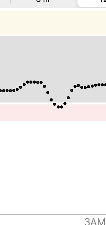 Compression Low On Dexcom G6 Tips Tech And Gear Fudiabetes