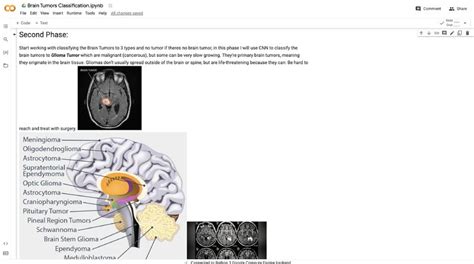 Khalid Khader On Linkedin I Have Begun Working On The Second Phase Of The Brain Tumor