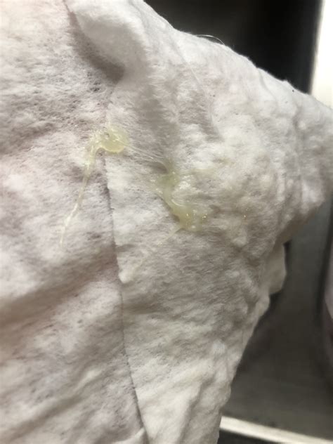 What Color Is The Mucus Plug Discharge