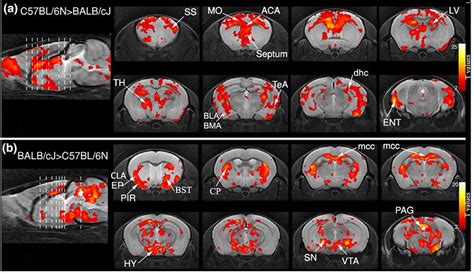 Inter Groups Statistical Comparison For Deformation Based Morphometry Download Scientific