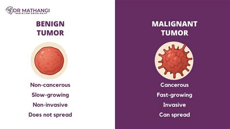 Differentiate Between Benign Tumor And Malignant Tumorbenign Vs