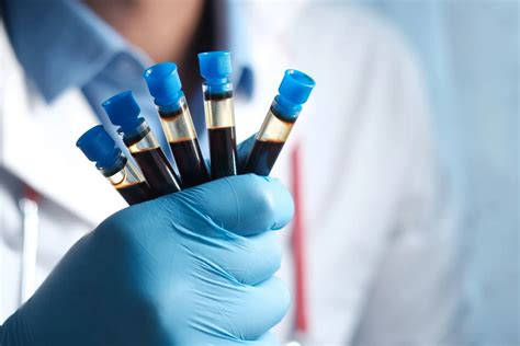 Time Critical Shipment Gnn Group