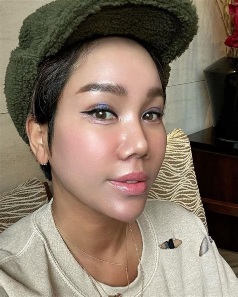 인`스타`그램 세상 김송 광대 이어 인중 축소수술 `실밥 제거 후 불편해서 웃지를 못해` Zum 뉴스