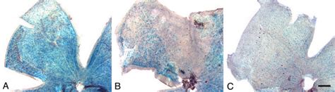 βgeo Staining Pattern Of Dba2jr3 Mice Showing Distinct Patterns Of