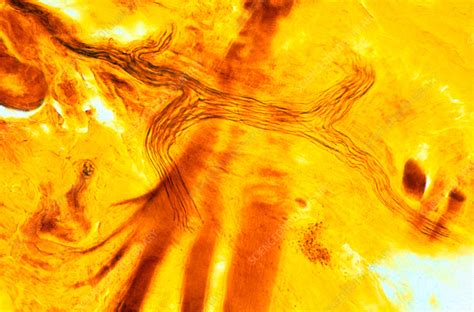 Nerve Fibres Light Micrograph Stock Image C059 9867 Science Photo Library