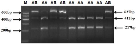 Polymerase Chain Reaction Restriction Fragment Length Polymorphism